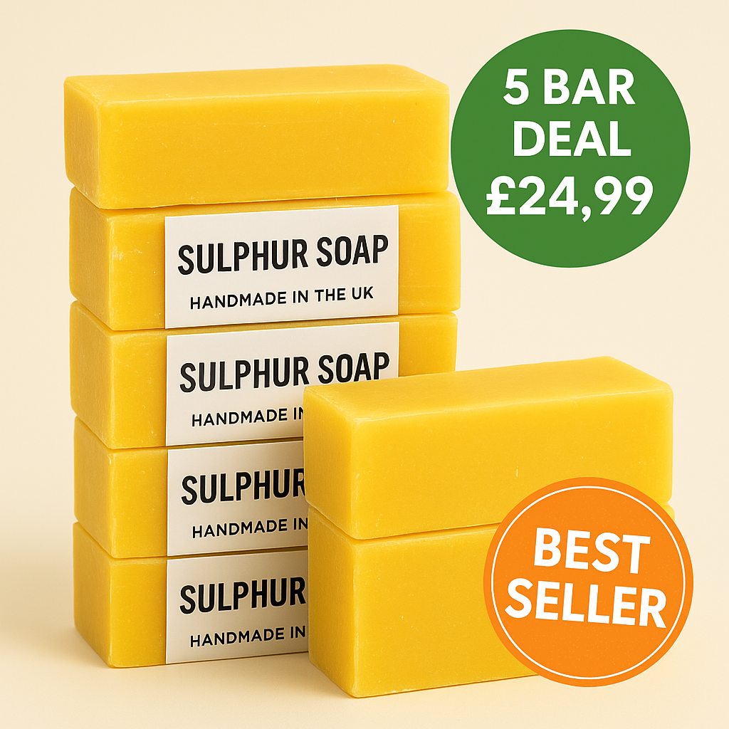 5 x Sulphur Soap Bars – Best Sulfur Acne & Eczema Soap – Free UK ...